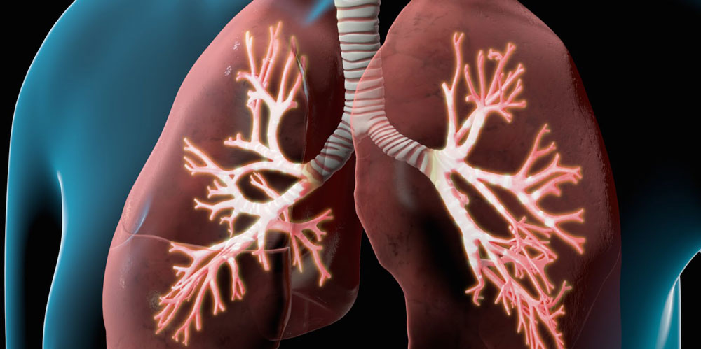 Ayurvedic Treatment for Acute & Allergic Bronchitis in Kerala, India